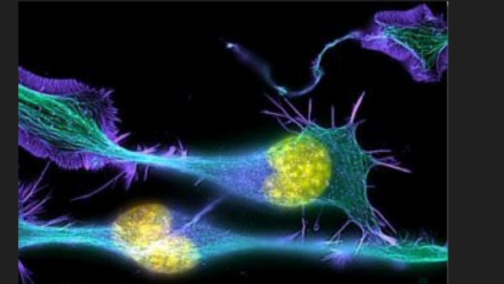 Yale University Team rewires behavioral brain neurons in a mutant worm ...